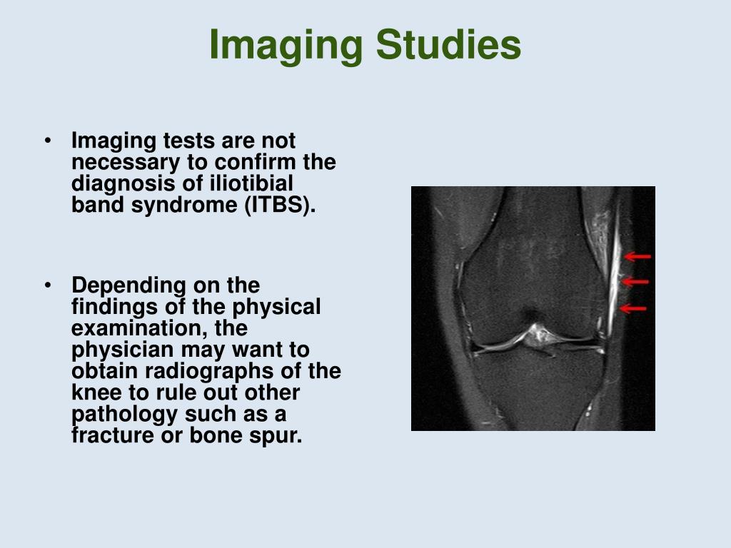Iliotibial Band Syndrome Mri