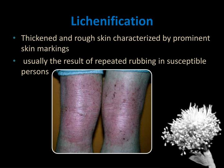 PPT - Skin Pathology PowerPoint Presentation - ID:2251415