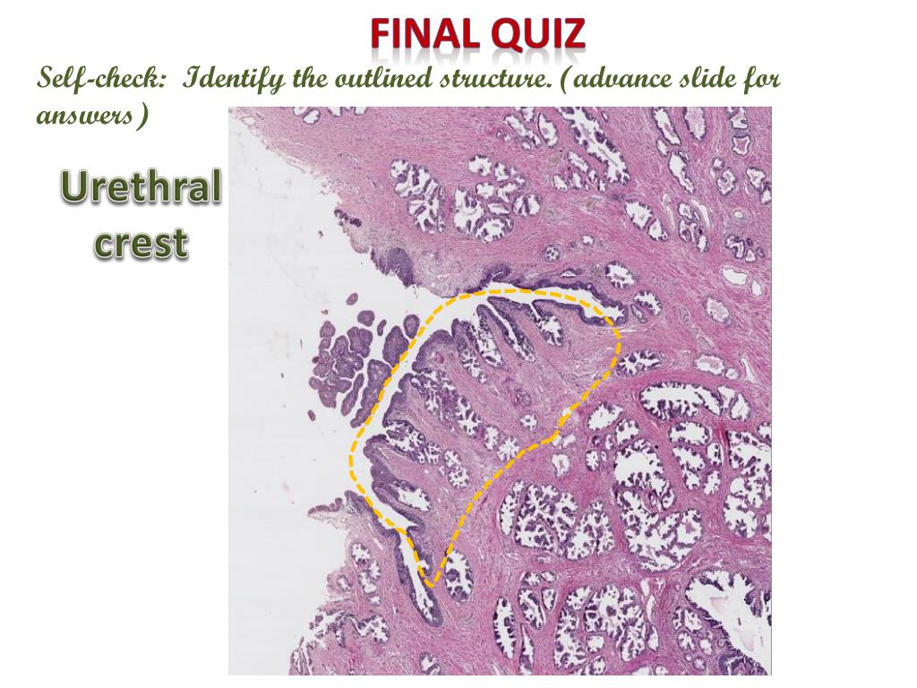 PPT - Male Accessory Glands and Penis Digital Laboratory PowerPoint ...