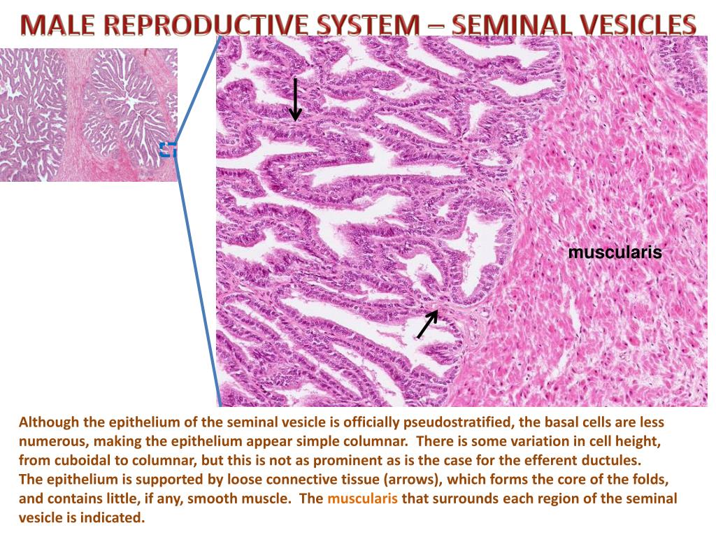 PPT - Male Accessory Glands and Penis Digital Laboratory PowerPoint ...