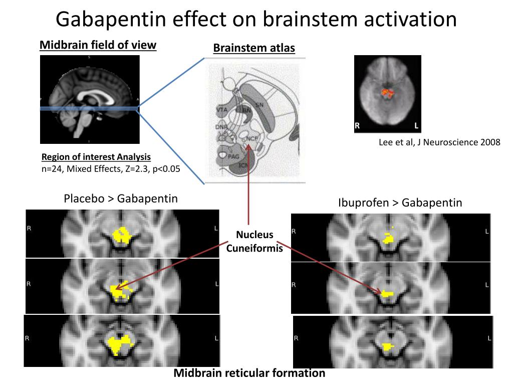PPT - PHARMARCOLOGICAL FUNCTIONAL MRI FOR NEUROPATHIC PAIN: EVALUATING ...