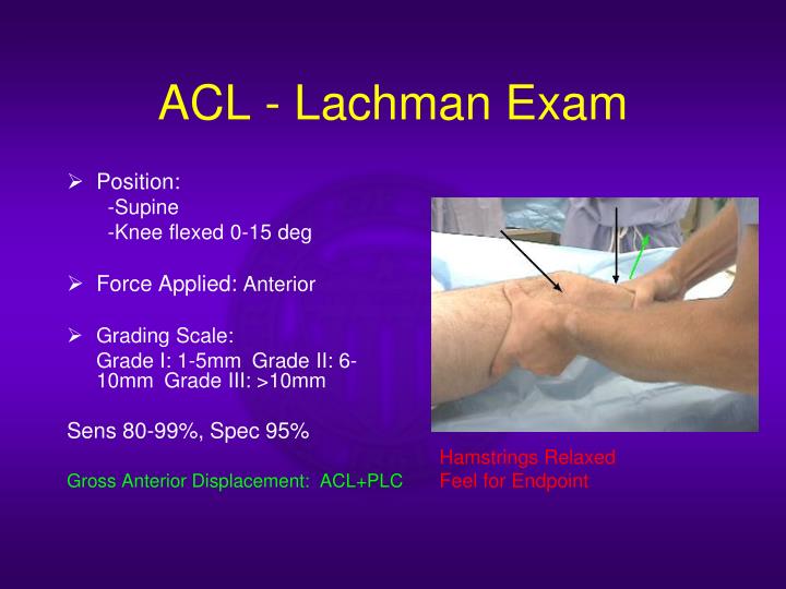 PPT - The Knee: Clinical Evaluation PowerPoint Presentation - ID:2251673