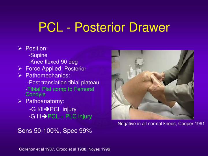 PPT - The Knee: Clinical Evaluation PowerPoint Presentation - ID:2251673