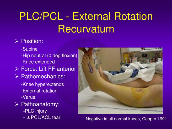 PPT - The Knee: Clinical Evaluation PowerPoint Presentation - ID:2251673