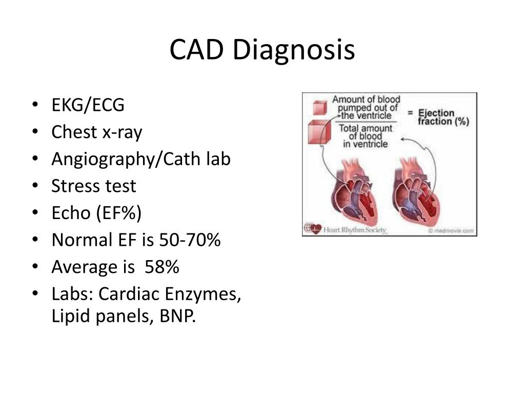 PPT - Circulatory Diseases and Treatments PowerPoint Presentation, free ...
