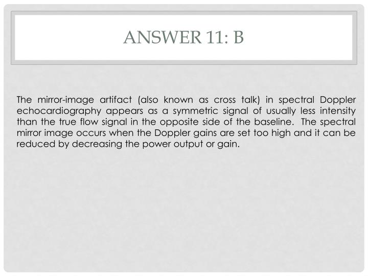 PPT - Cardiac ultrasound artifacts PowerPoint Presentation - ID:2253539