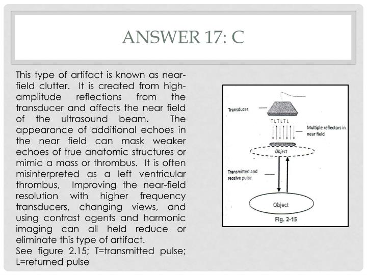 PPT - Cardiac ultrasound artifacts PowerPoint Presentation - ID:2253539