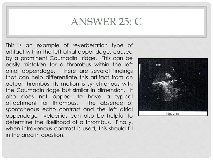 PPT - Cardiac ultrasound artifacts PowerPoint Presentation - ID:2253539