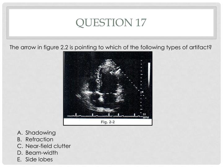 PPT - Cardiac ultrasound artifacts PowerPoint Presentation - ID:2253539