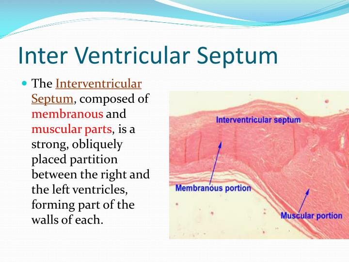 PPT - Middle mediastinum PowerPoint Presentation - ID:2254704