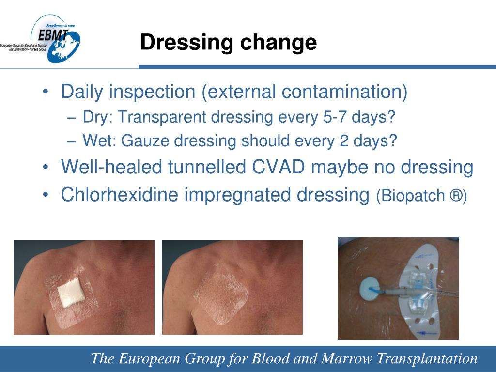 PPT - How well are we doing with CVC’s in EBMT? London 5th October 2012 ...