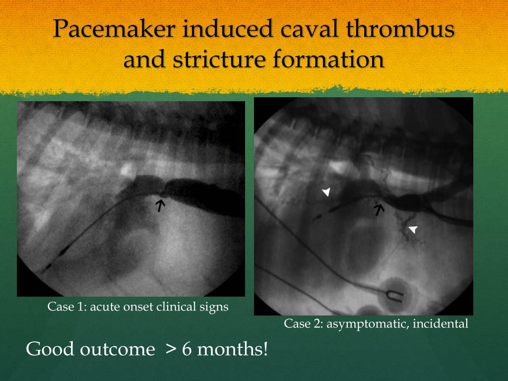 PPT - Cranial Vena Cava Syndrome Isn’t that the thing with heartworm ...
