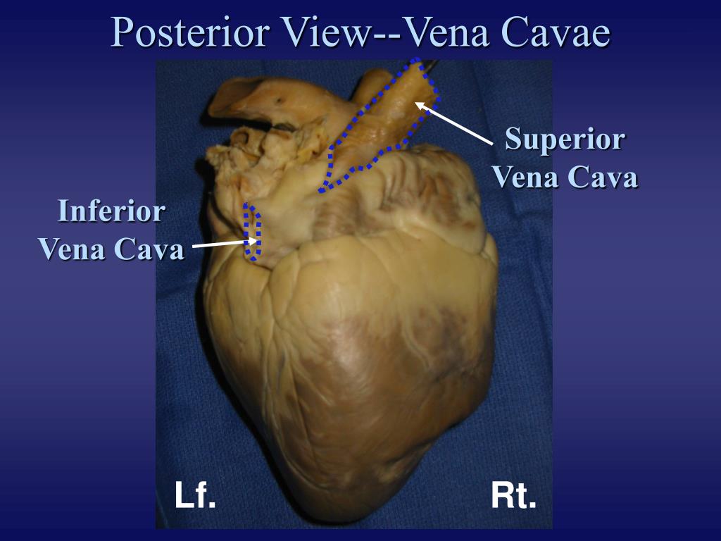 PPT Pig Heart Dissection PowerPoint Presentation Free Download ID PPT Pig Heart Dissection PowerPoint Presentation Free Download ID