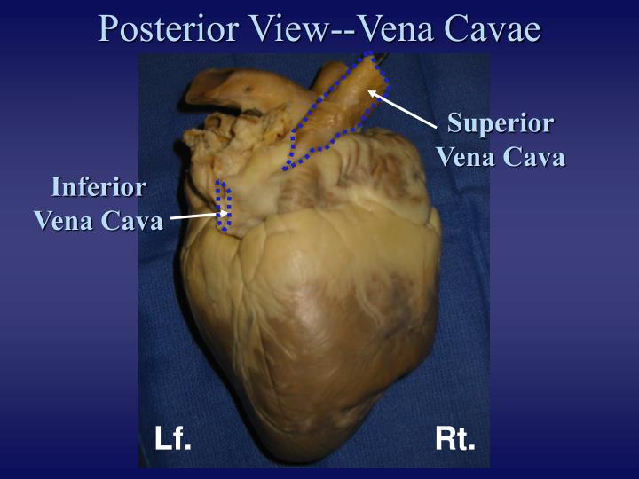 PPT - Pig Heart Dissection PowerPoint Presentation - ID:2255179