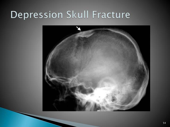 PPT - Chapter 7:4 Skeletal System PowerPoint Presentation - ID:2255263