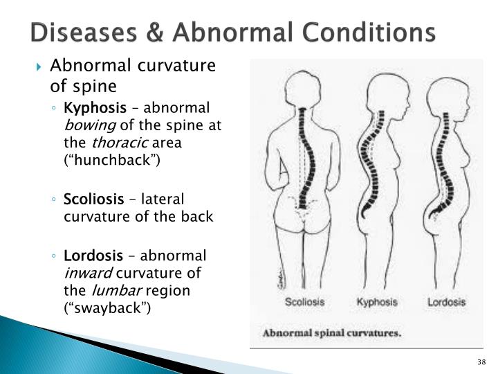 PPT - Chapter 7:4 Skeletal System PowerPoint Presentation - ID:2255263