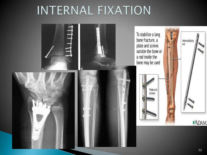 PPT - Chapter 7:4 Skeletal System PowerPoint Presentation - ID:2255263