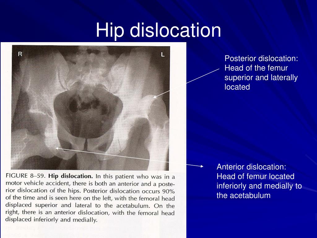 PPT Lower Extremities PowerPoint Presentation Free Download ID 2255349