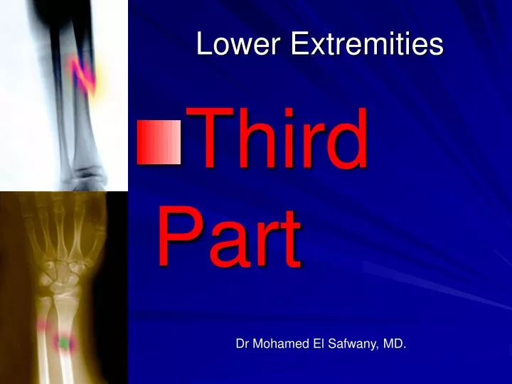 PPT - Lower Extremities PowerPoint Presentation, free download - ID:2255349