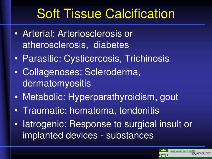 PPT - Soft Tissue Calcifications PowerPoint Presentation - ID:2257854