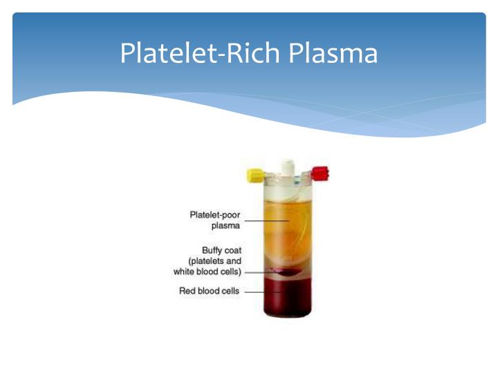 PPT - PRP for Lateral Epicondylitis PowerPoint Presentation - ID:2258315