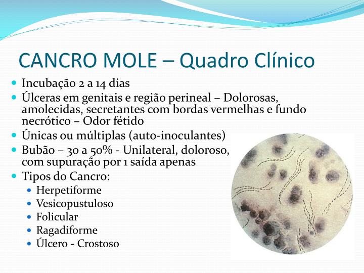 PPT - DOENÇAS SEXUALMENTE TRANSMISSÍVEIS PowerPoint Presentation - ID ...