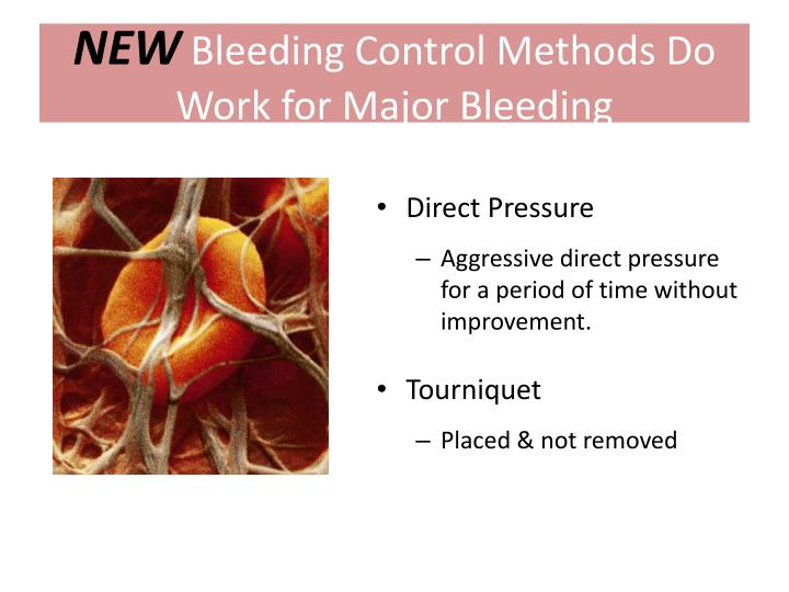 PPT - TOURNIQUETS PowerPoint Presentation - ID:2259763