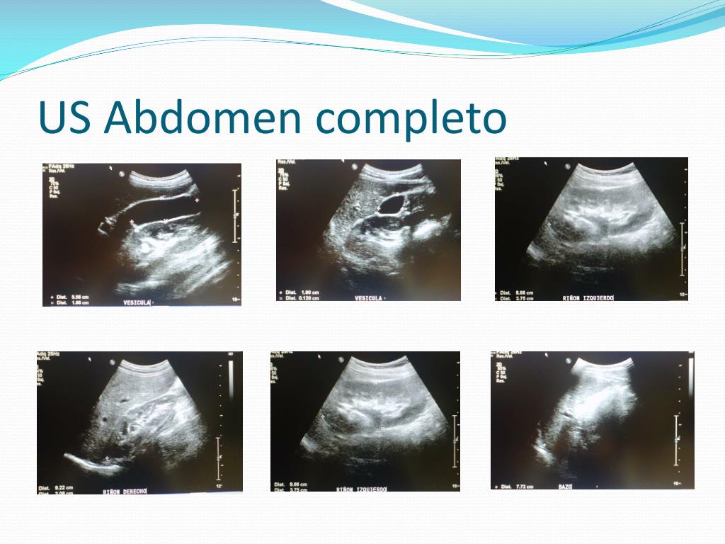 PPT - Hospital Ángeles del Pedregal Sesión General PowerPoint ...