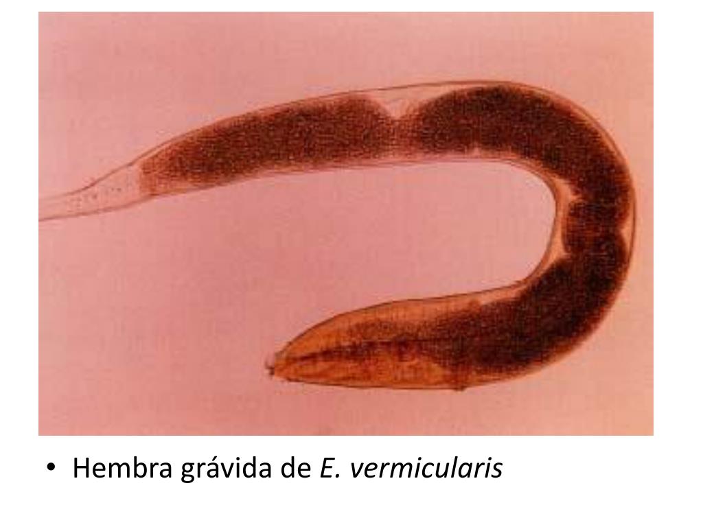 PPT - Nematodiosis intestinales PowerPoint Presentation, free download ...