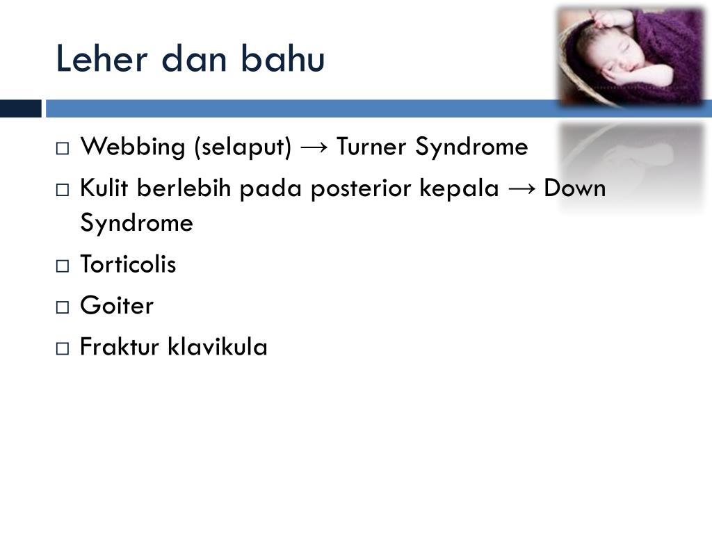PPT - Pemeriksaan Fisik Bayi PowerPoint Presentation, free download ...