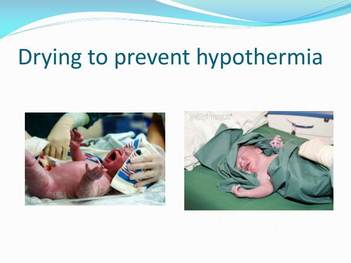 PPT - Neonatal Assessment PowerPoint Presentation - ID:2264004
