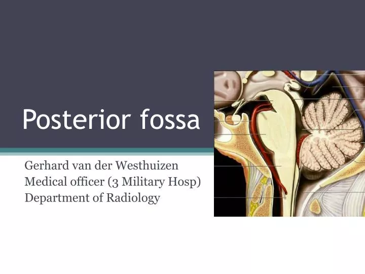 PPT - Posterior fossa PowerPoint Presentation, free download - ID:2264046