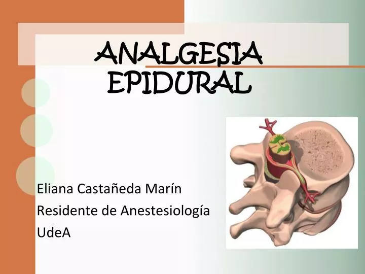 PPT - ANALGESIA EPIDURAL PowerPoint Presentation, free download - ID ...