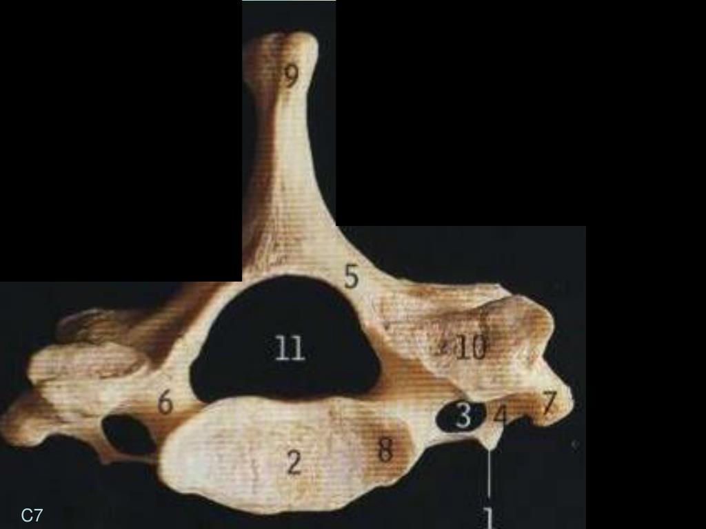 PPT - COLUMNA VERTEBRAL Huesos y Articulaciones PowerPoint Presentation ...