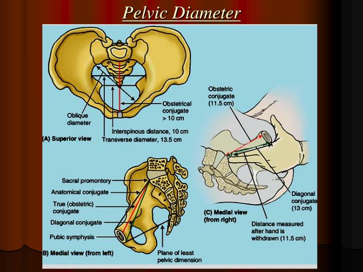 PPT - Bony Pelvic Wall and Pelvic Cavity PowerPoint Presentation - ID ...