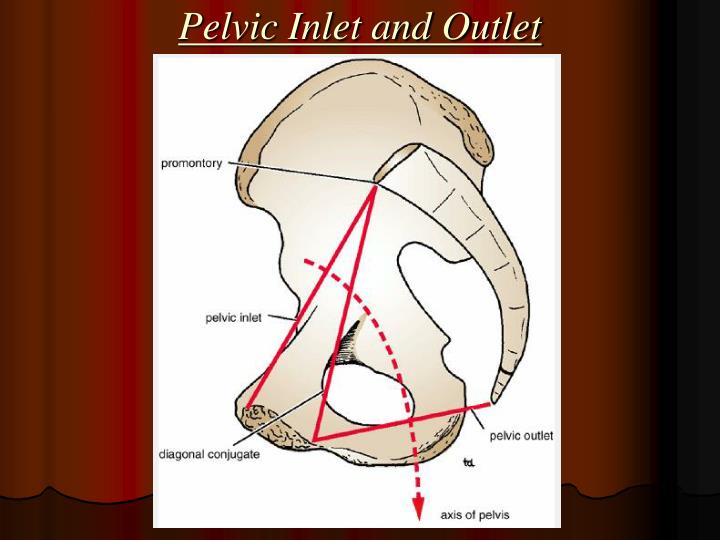 PPT - Bony Pelvic Wall and Pelvic Cavity PowerPoint Presentation - ID:2267172