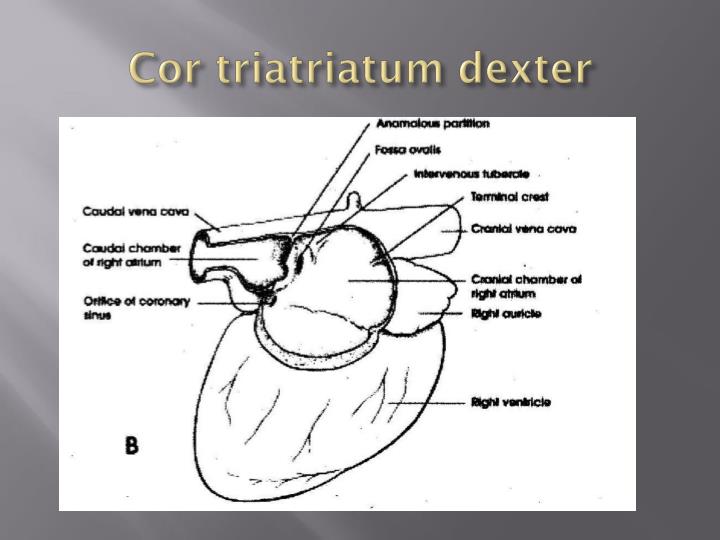 PPT - Cor triatriatum dexter PowerPoint Presentation - ID:2267182