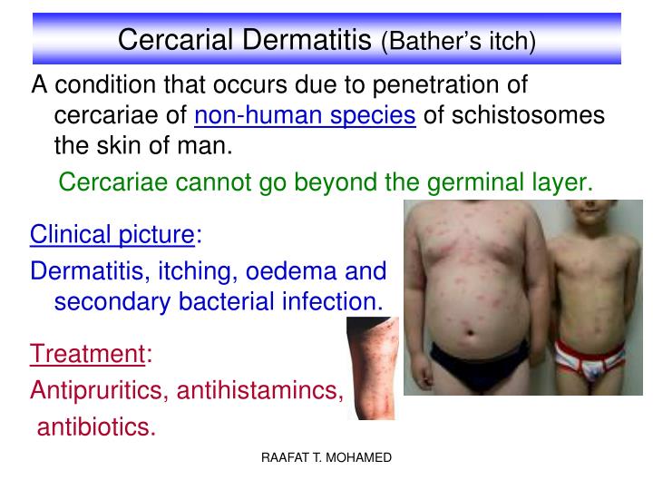 PPT - Schistosoma Parasites PowerPoint Presentation - ID:2267795