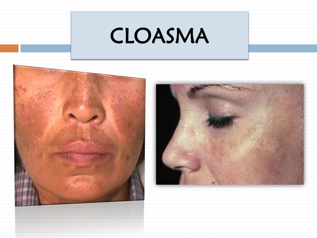 PPT - EL HIGADO Y SU PAPEL EN LAS ENFERMEDADES DE LA PIEL PowerPoint ...