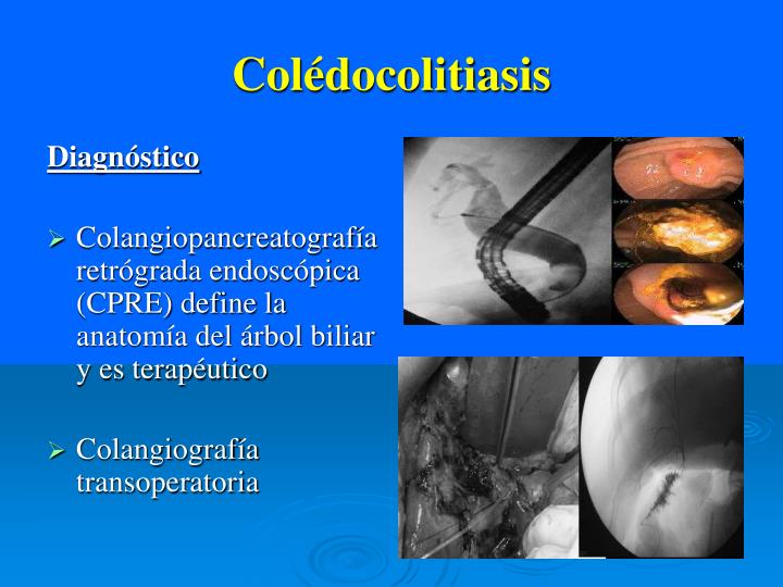 PPT - PATOLOGÍA BILIAR PowerPoint Presentation - ID:2267828