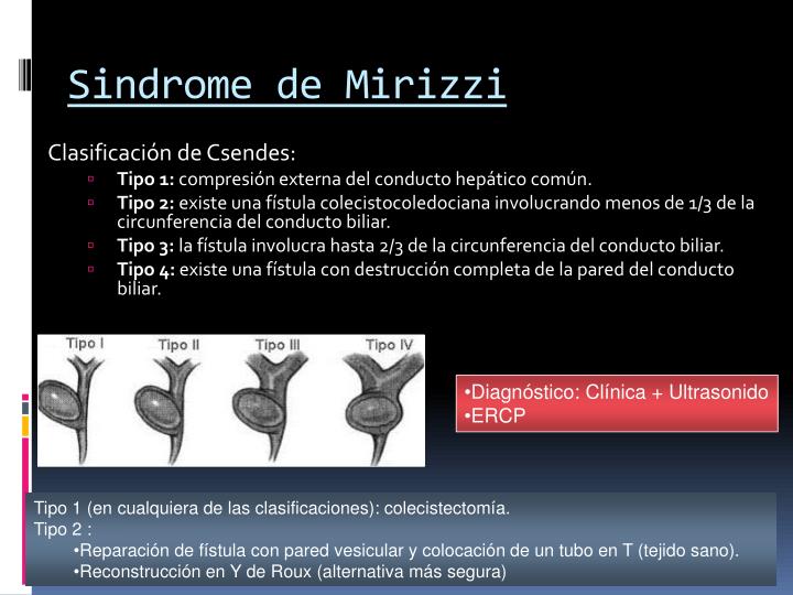 PPT - Patología Biliar PowerPoint Presentation - ID:2267862