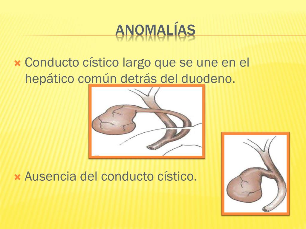 PPT - Afección litiásica biliar PowerPoint Presentation, free download ...