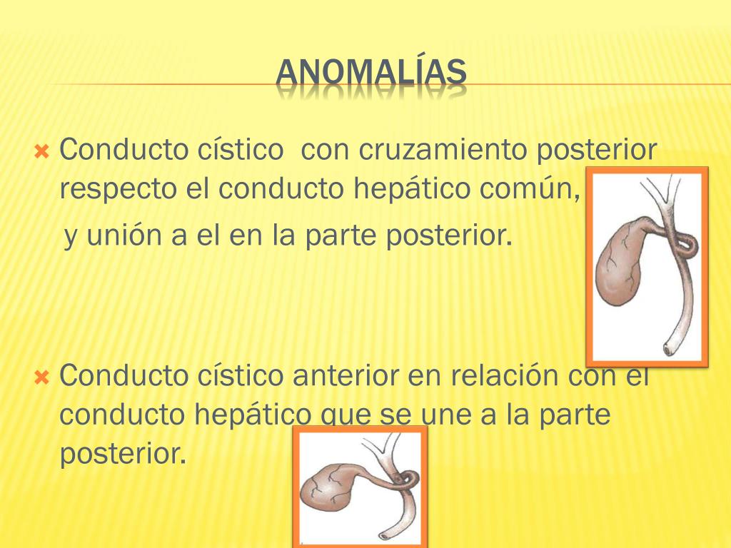 PPT - Afección litiásica biliar PowerPoint Presentation, free download ...