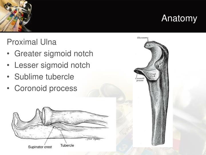 PPT - Lateral Elbow Instability PowerPoint Presentation - ID:2268664