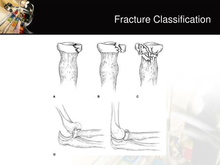 PPT - Lateral Elbow Instability PowerPoint Presentation - ID:2268664