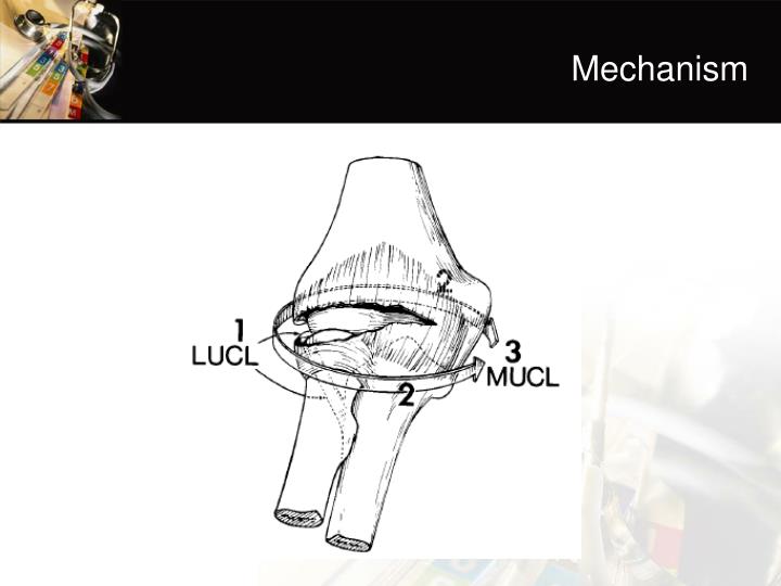 PPT - Lateral Elbow Instability PowerPoint Presentation - ID:2268664