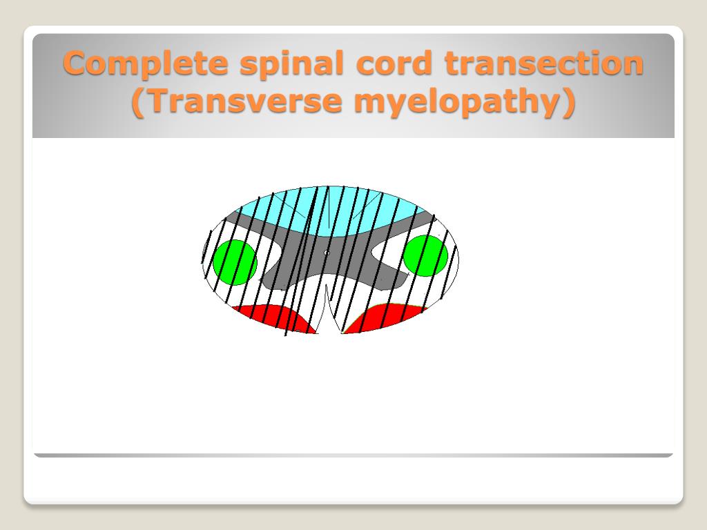 PPT - Chronic Spinal Cord Injury (Lesi Medula Spinalis Khronis ...