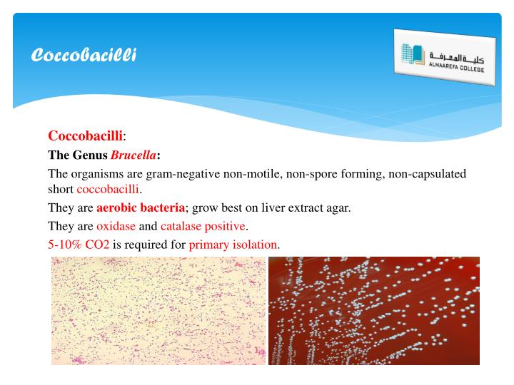 PPT - Gram Negative Bacilli PowerPoint Presentation - ID:2269606