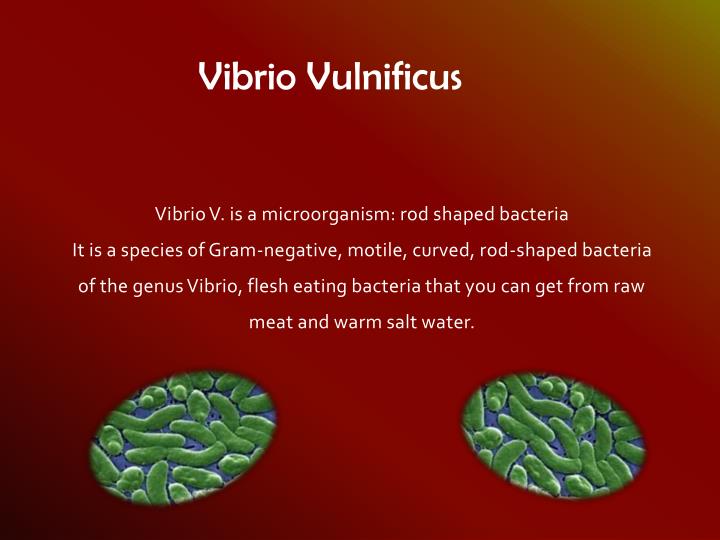 PPT - Vibrio Vulnificus PowerPoint Presentation - ID:2269897