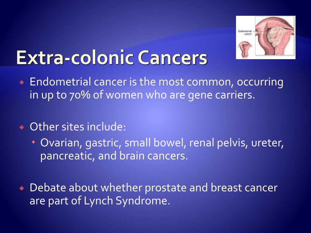 PPT - Hereditary non- polyposis colorectal cancer (Lynch syndrome ...